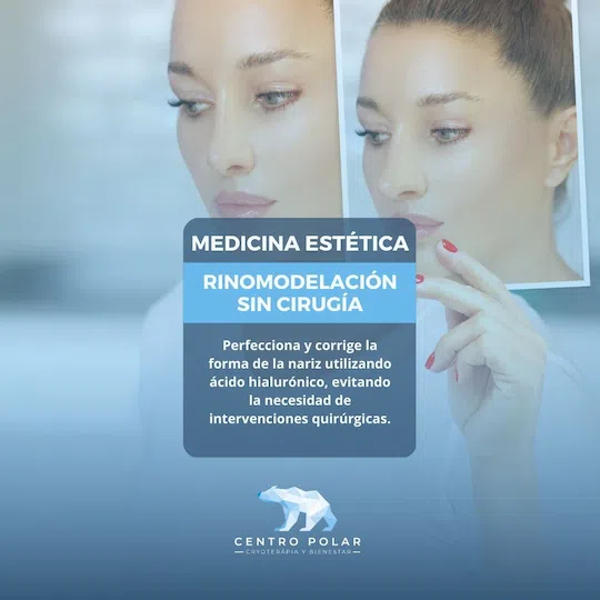 5 Razones para elegir la rinomodelación sin cirugía en nuestra clínica - Clínica Polar